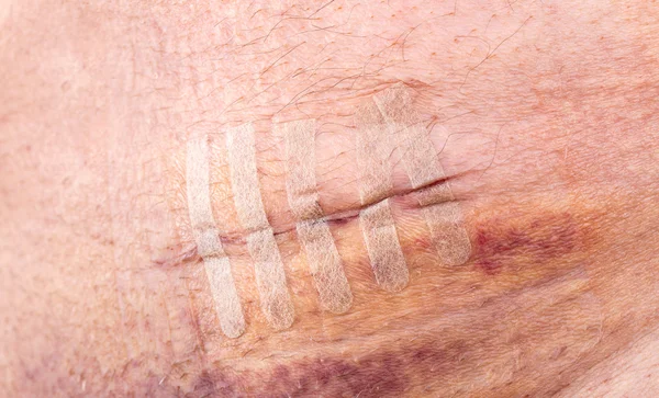 Surgical anatomy Stock Photos, Royalty Free Surgical anatomy Images ...