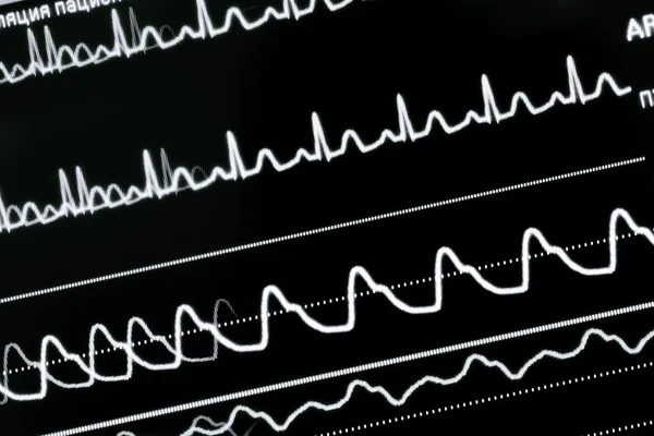 Polygraph testing Stock Photos, Royalty Free Polygraph testing Images ...