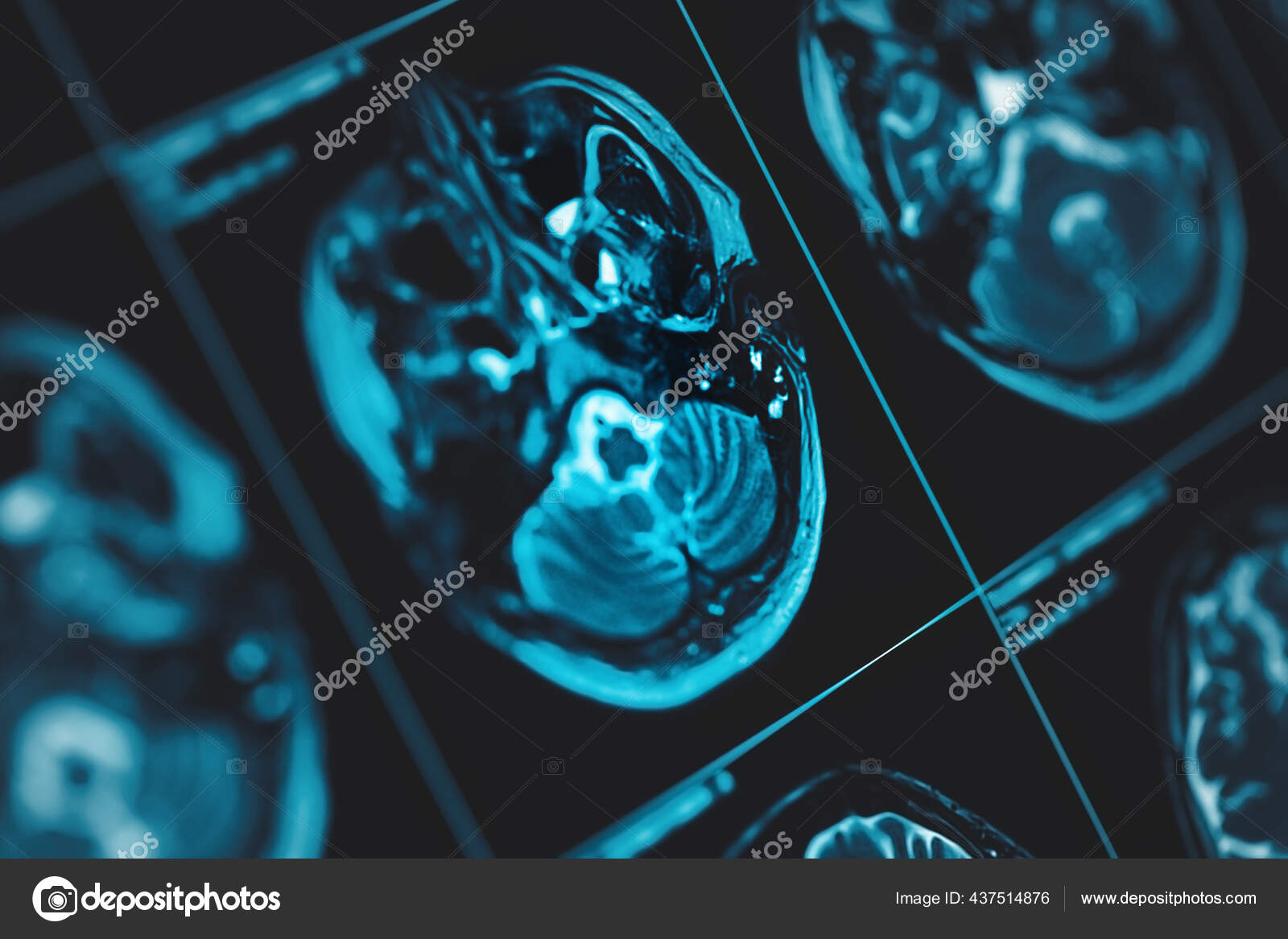 Mri Scan Human Head Close Healthcare Background Stock Photo by ©sudok1 ...