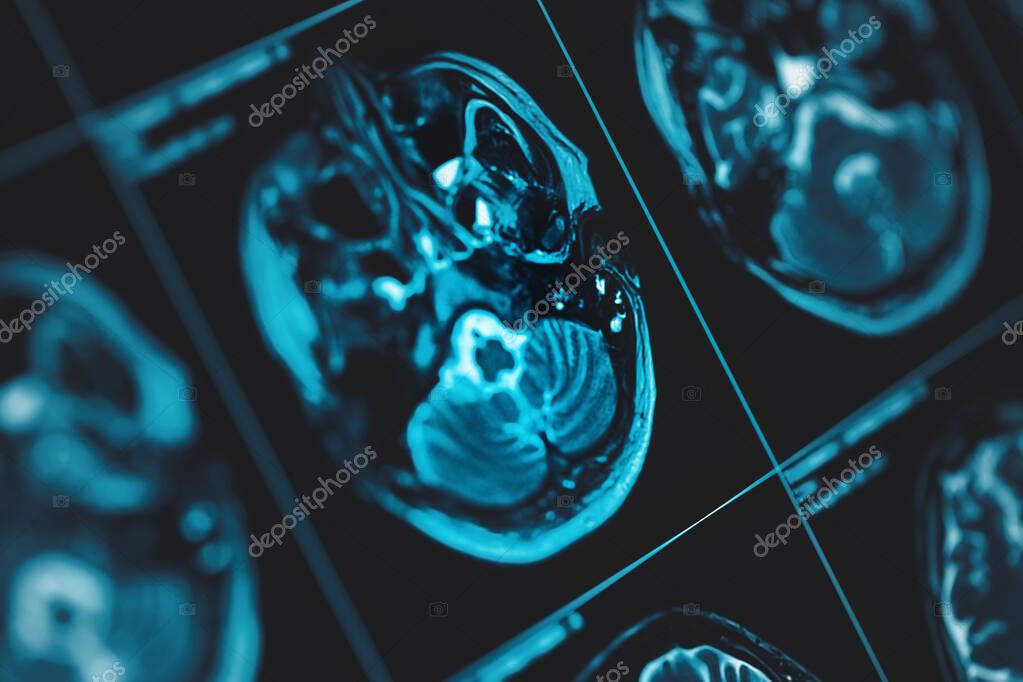 Resonancia magnética del primer plano de la cabeza humana como ...