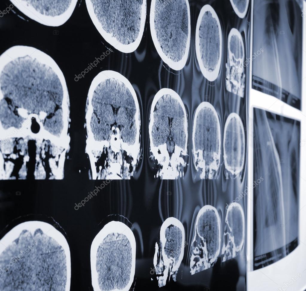 Unusual view of the MRI, X-ray images of the patient — Stock Photo ...
