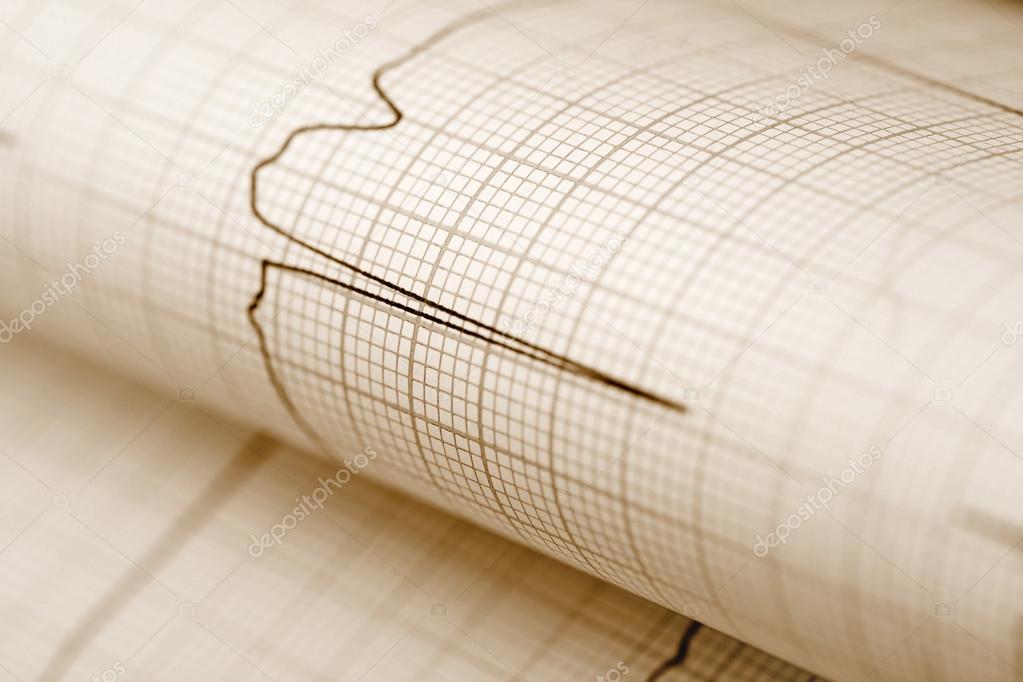 ECG paper medical background Stock Photo by ©sudok1 67911617