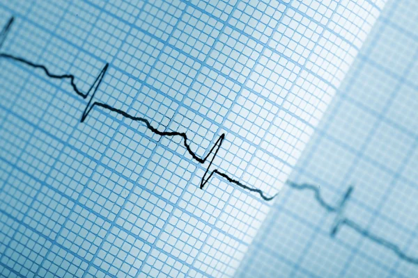 Cardiogram Stock Photos, Royalty Free Cardiogram Images | Depositphotos