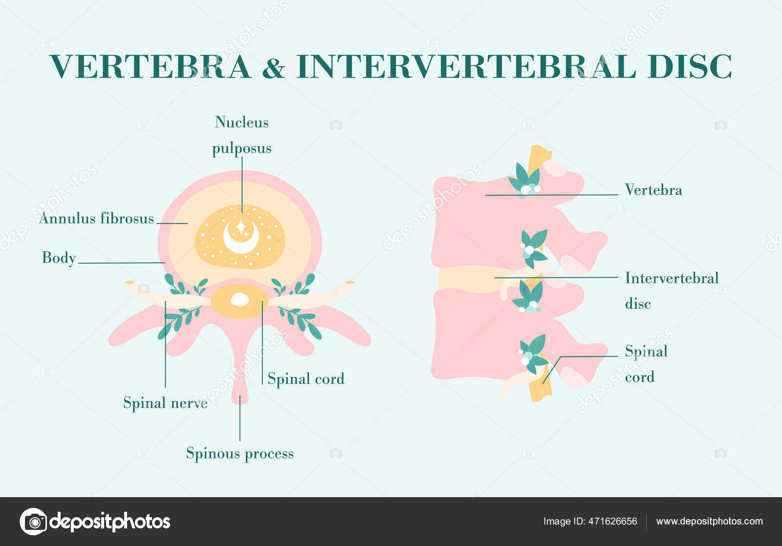 Healthy vertebrae and intervertebral discs, patient-friendly diagram ...