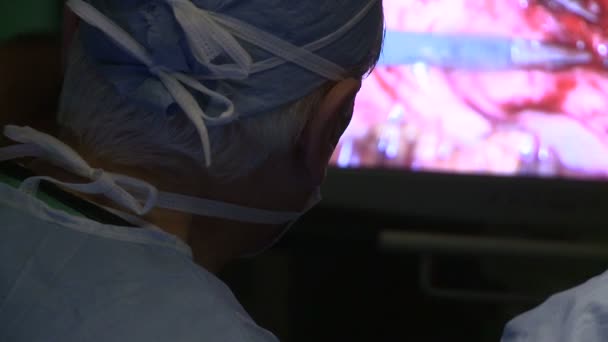 585 vídeos de Laparoscopic appendectomy, metraje de Laparoscopic ...