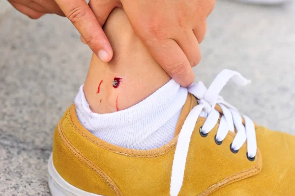 Ankle injury Stock Photos & Royalty-Free Images | Depositphotos