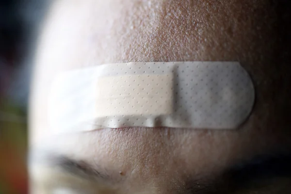 Herida sobre herida en la cabeza Stock Photos, Royalty Free Herida ...