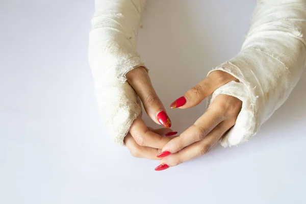 two female hands with broken wrists after falling from a bicycle in a ...