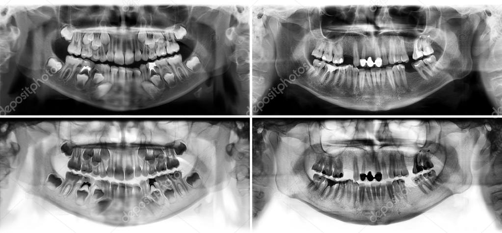 Dientes de rayos X dentales panorámicos de hombre joven de 30 treinta y ...