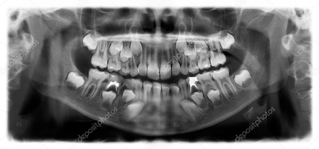 Radiografía dental panorámica del niño de siete 7 años — Foto de stock ...