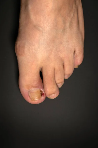 La cloque images libres de droit, photos de La cloque | Depositphotos