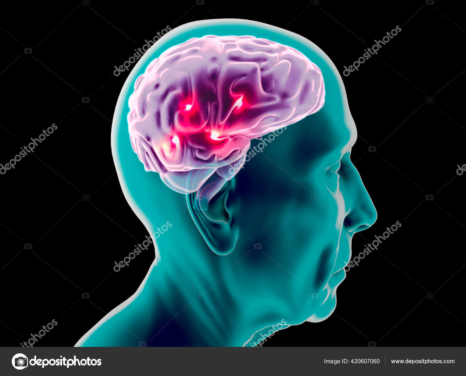 Vista Lateral Cerebro Anciano Neuronas Sinapsis Comunicación Estímulo ...