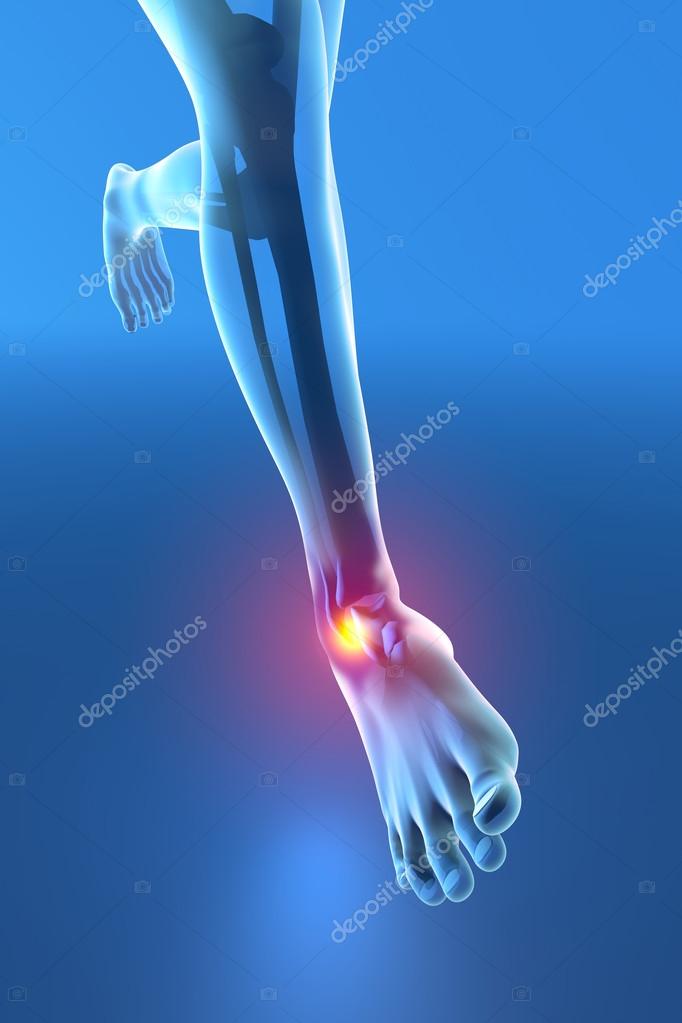 Sprained ankle blue x-ray — Stock Photo © vampy1 #57545973
