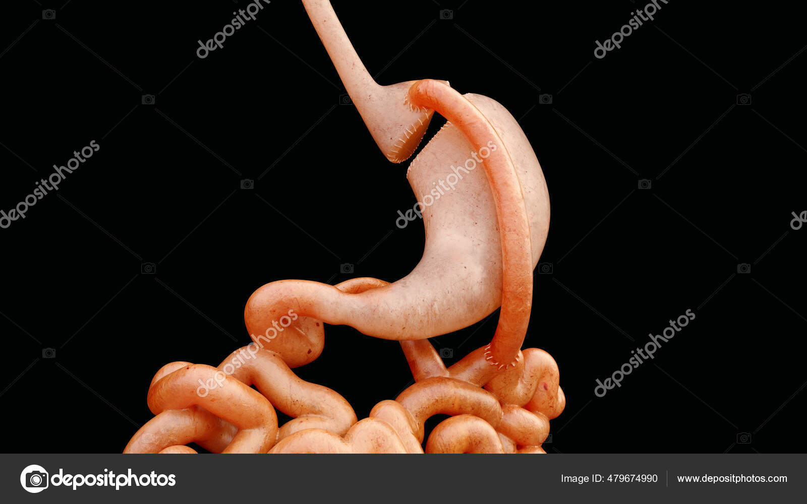 Roux Bypass Gástrico Representación: fotografía de stock © Crevis ...