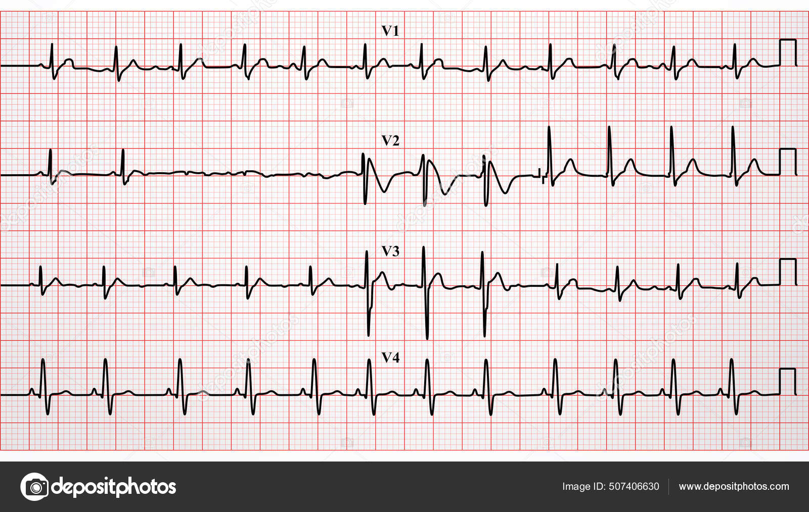 Eletrocardiograma Ecg Batimento Cardíaco Formato Vetorial imagem ...