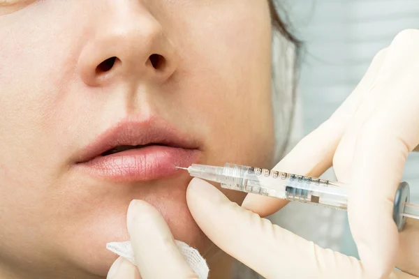 Lip injections Stock Photos, Royalty Free Lip injections Images ...