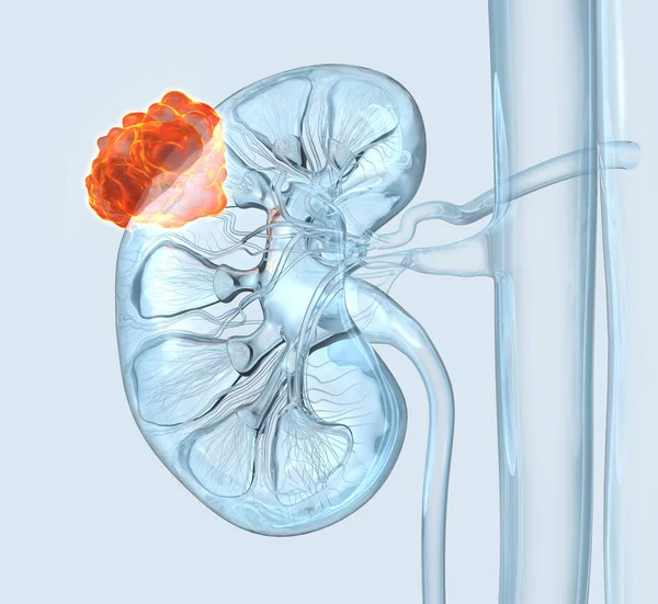 Rein du bassinet images libres de droit, photos de Rein du bassinet ...