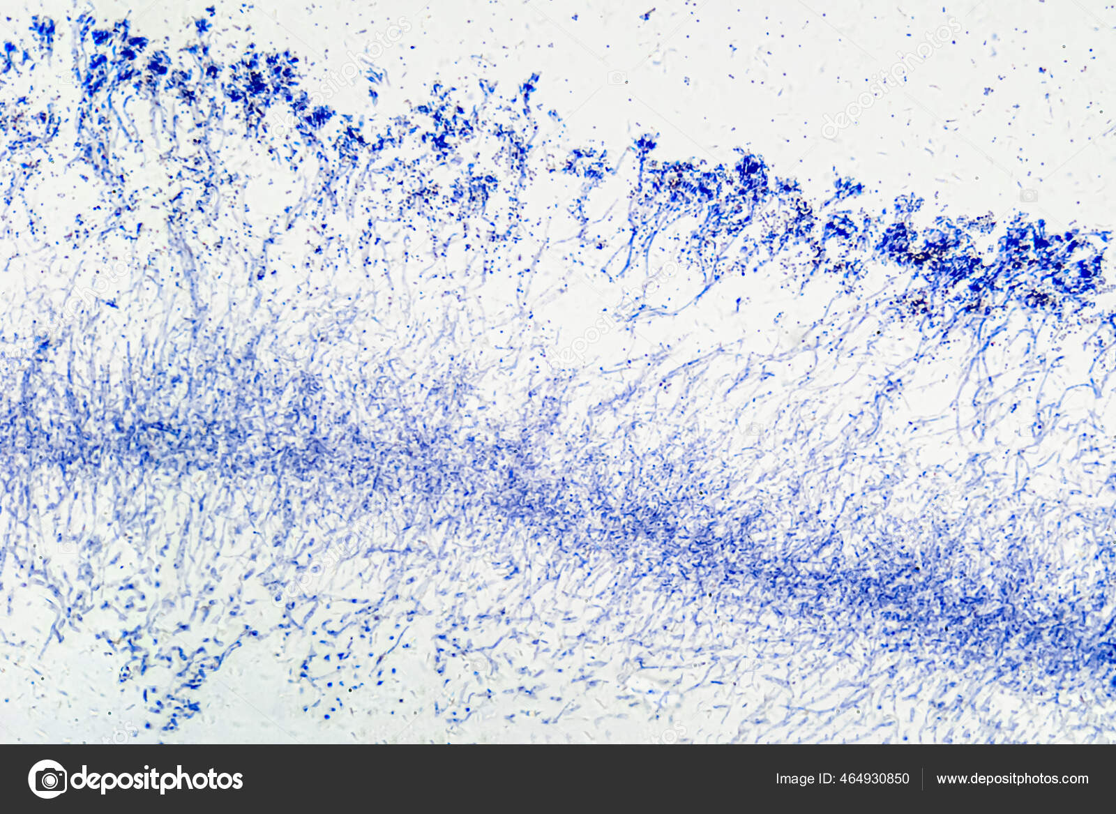 Penicillium Ascomycetous Svampar Ett Mikroskop Mycelium Den Vegetativa ...