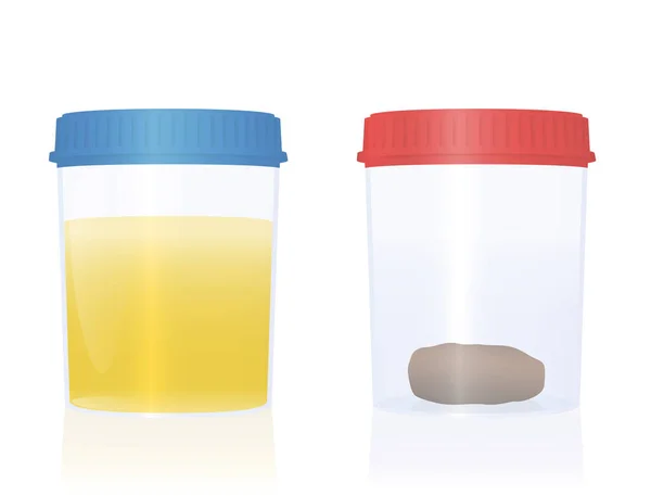 Urine cup Vector Art Stock Images | Depositphotos