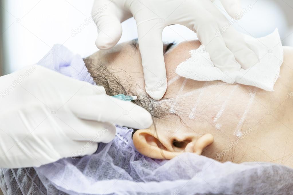 PDO Suture operation Stock Photo by ©AppleEyesStudio 75083153