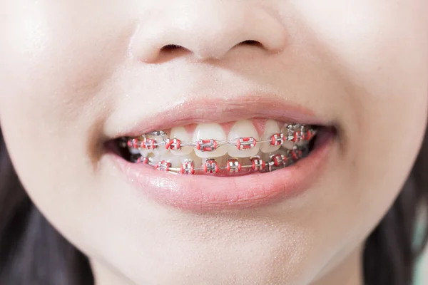 Red Braces — Stock Photo © jlueders #6528677