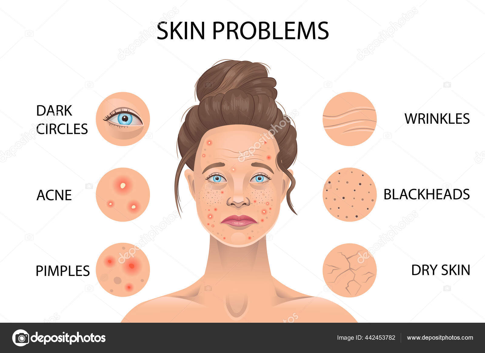 Skin Problems Vector Illustration Stock Vector Image by ©Yucalora ...