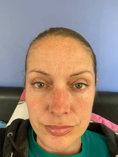 Bruised face woman Stock Photos, Royalty Free Bruised face woman Images ...