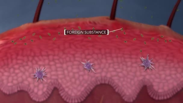 Attack Airborne Bacteria Skin Wound Activation Immune System — Stock ...