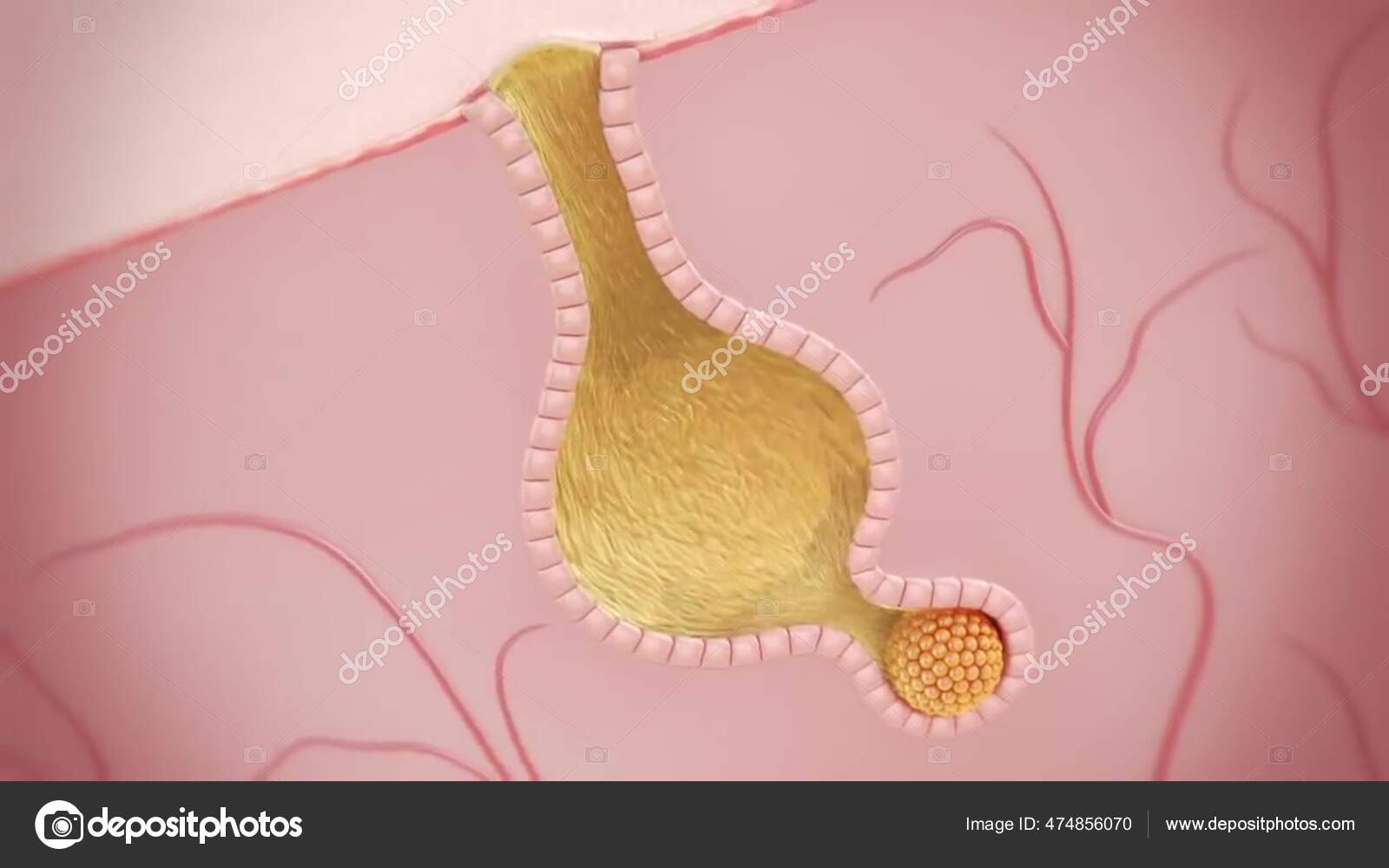 Acne Pimples Stages Development Graphic Animation — Stock Photo ...