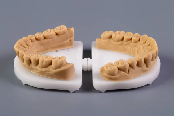 Mold of teeth. Gypsum model plaster of teeth. Plaster cast of teeth ...