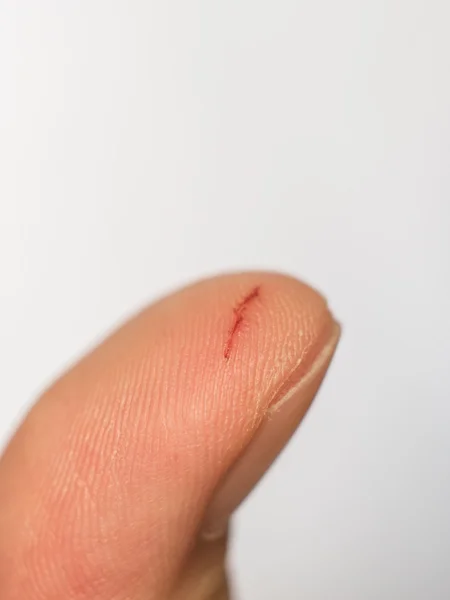 Danos mordida Stock Photos, Royalty Free Danos mordida Images ...