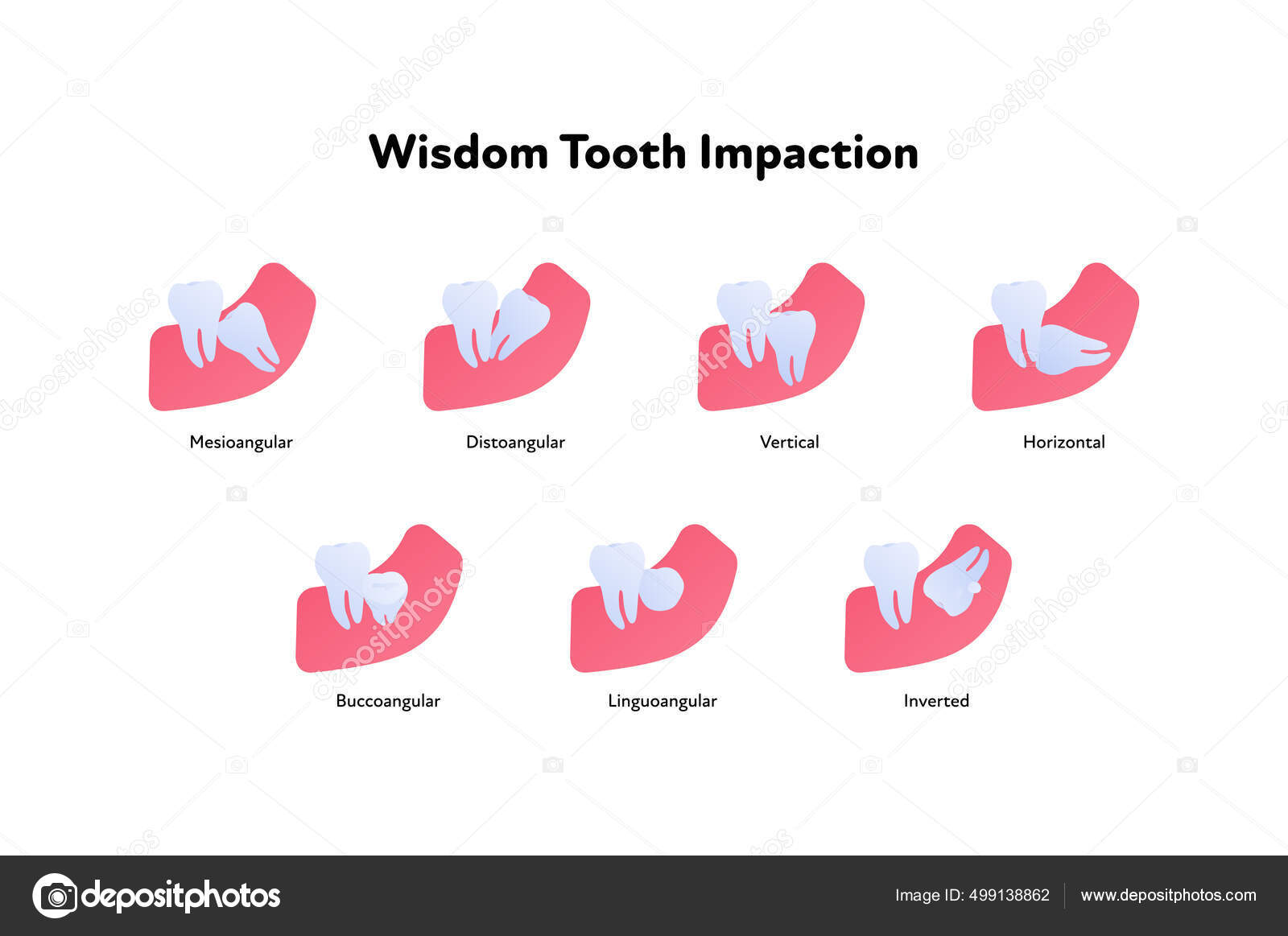 Tandanatomi Diagram Vektor Biomedicinsk Illustration Tvärsnitt ...