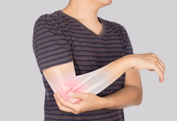 Elbow Bones Injury White Background Elbow Pain — Stock Photo ...