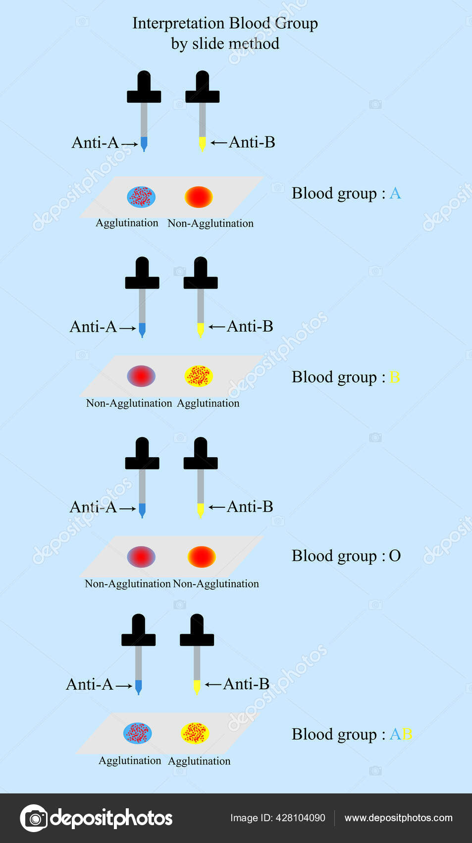 Interpretation Blood Group Abo System Slide Method Laboratory Stock ...