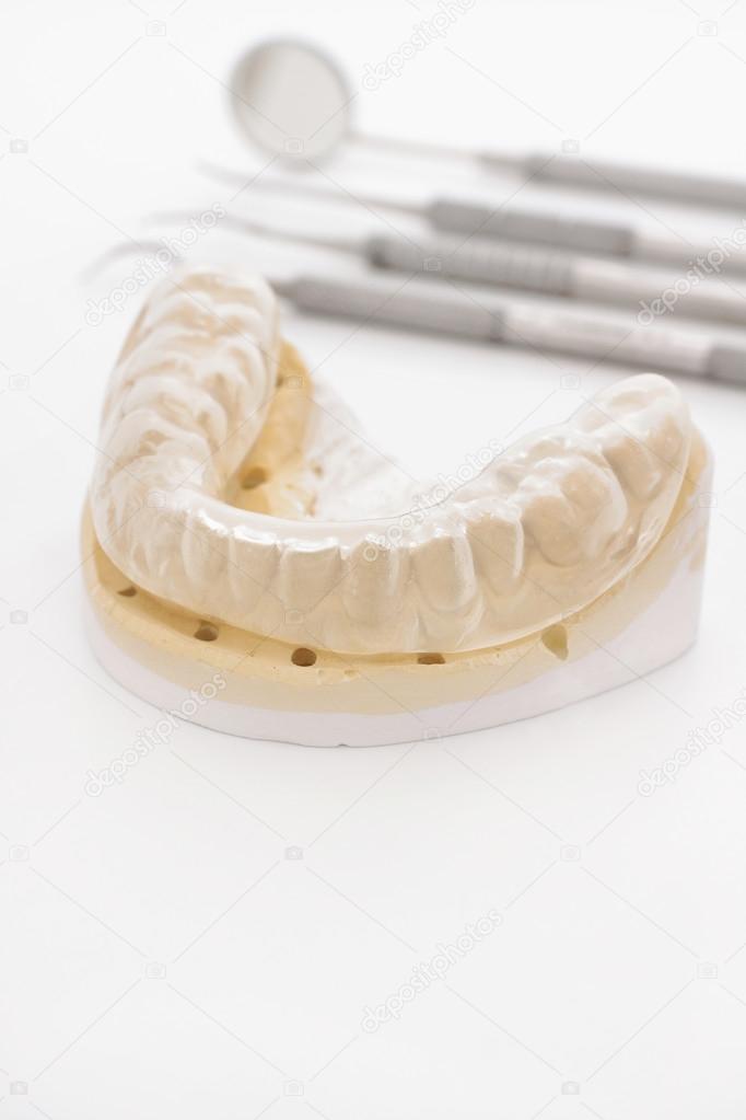 Orthodontic Cast and Dental Tools — Stock Photo © Dpimborough #86977564