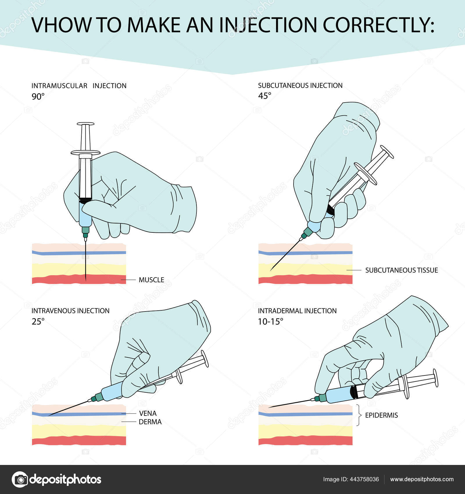 Como Fazer Uma Injeção Corretamente Infográficos Para Diferentes Tipos ...