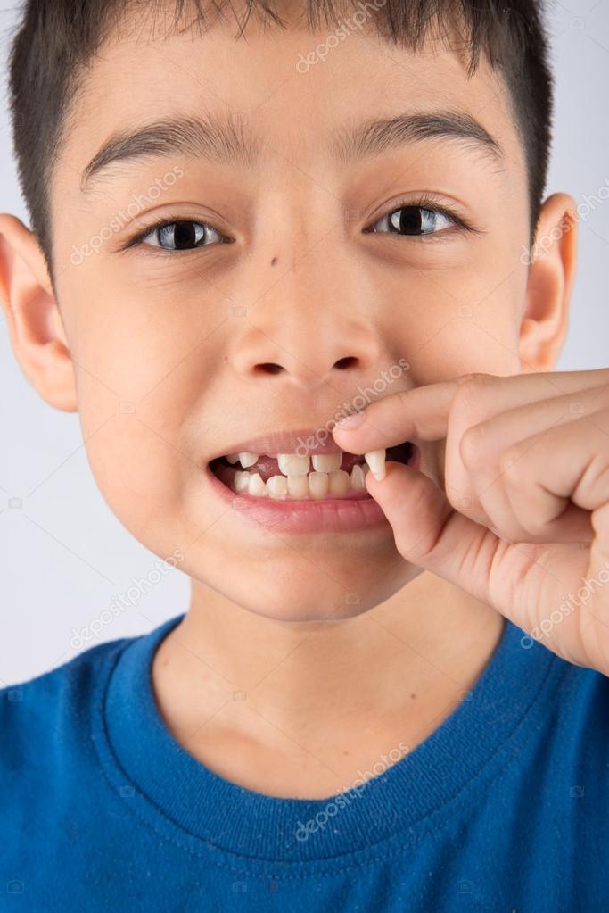 Little boy showing baby teeth toothless close up waiting for new teeth ...