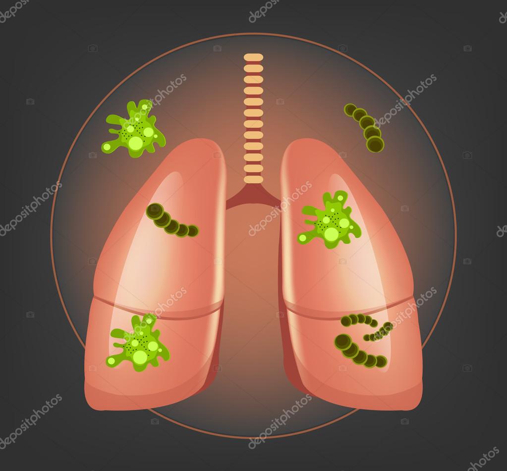 Lungs with germs and bacteria. Vector illustration Stock Vector Image ...