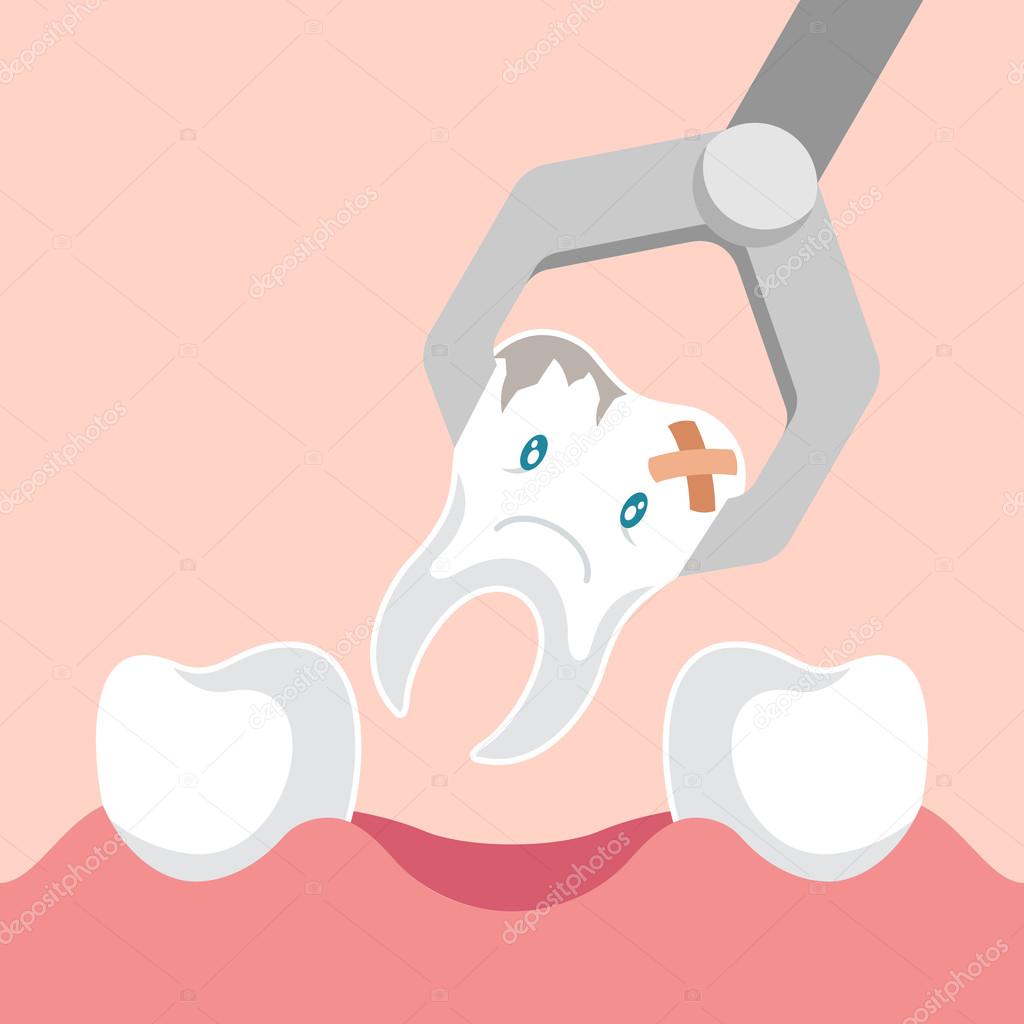 Pinzas y dientes de extracción dental. Ilustración plana del vector 2024