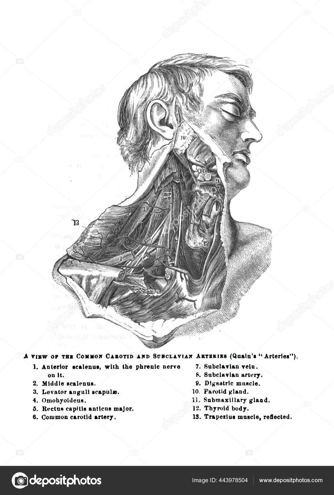 Subclavian Artery Branches
