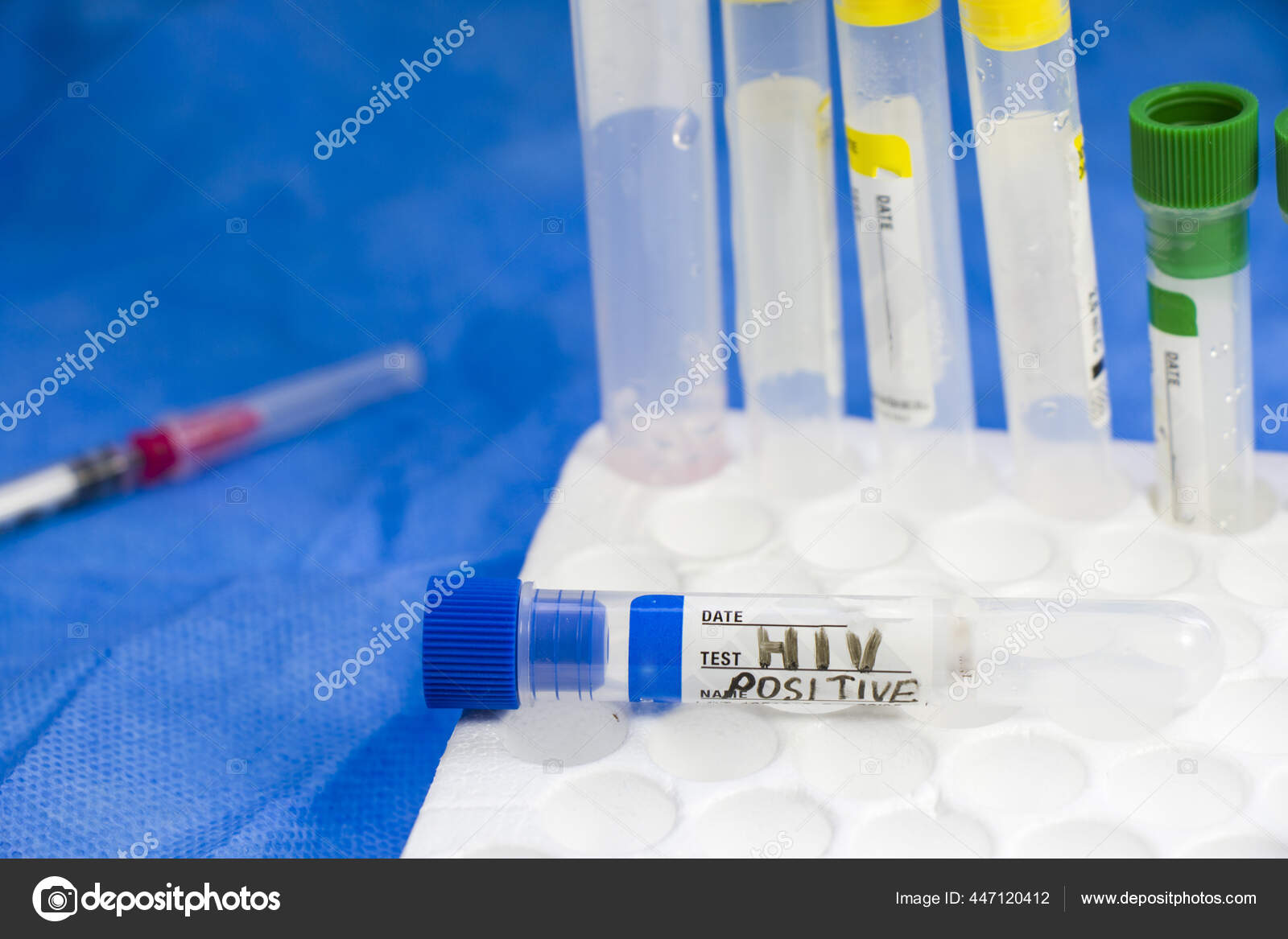 High Angle Empty Positive Hiv Test Tube Laboratory — Stock Photo ...