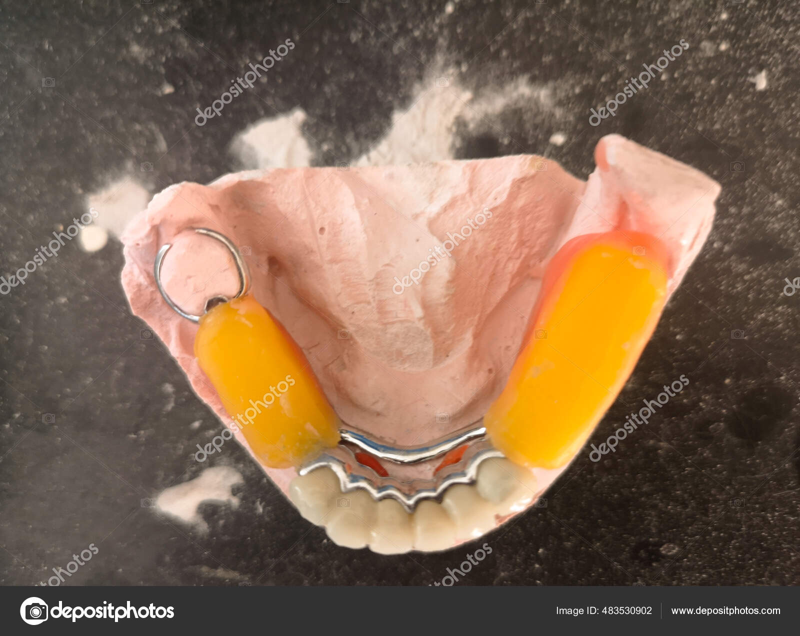 Top View Dental Laboratory Prosthesis Gray Backgroun Stock Photo by ...