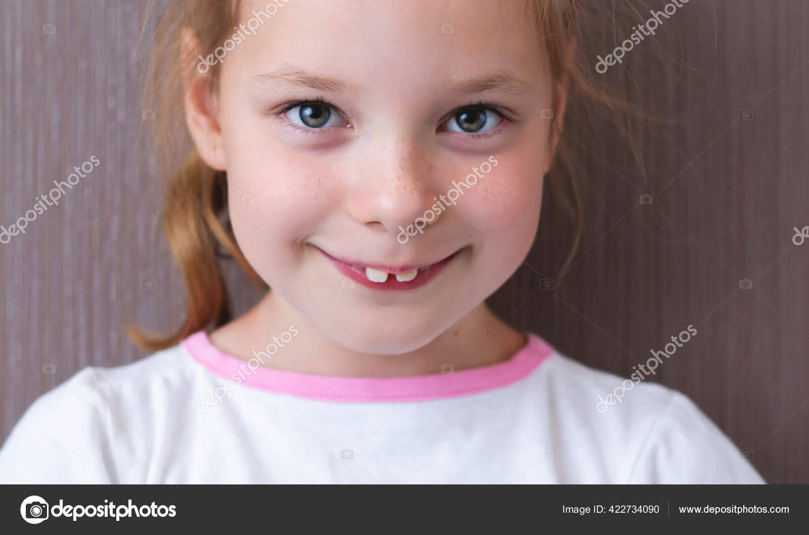 Kid Projecting Upper Front Teeth — Stock Photo © Martyna1802 #422734090