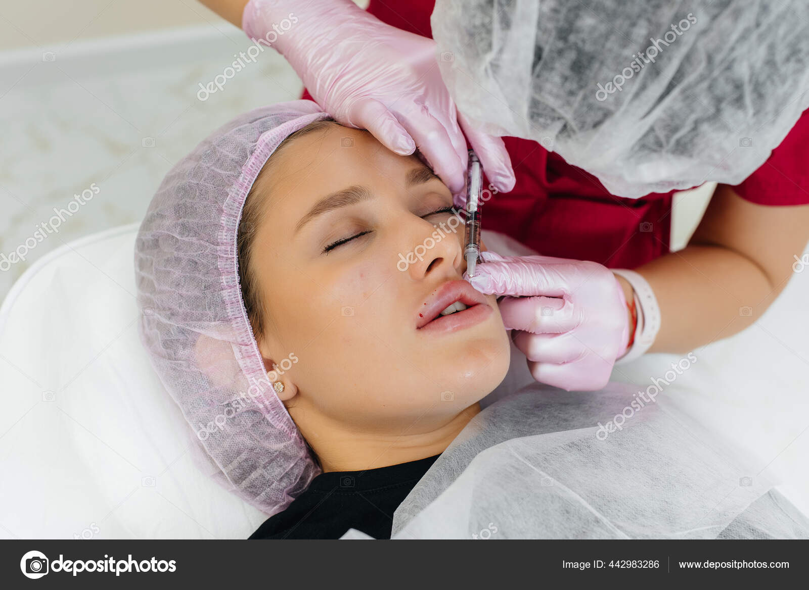 Cosmetology Procedure Lip Augmentation Wrinkle Removal Young Beautiful ...