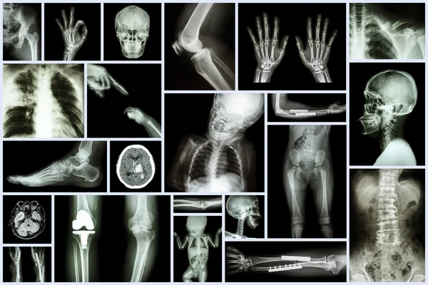 Xray Stock Photos, Royalty Free Xray Images | Depositphotos