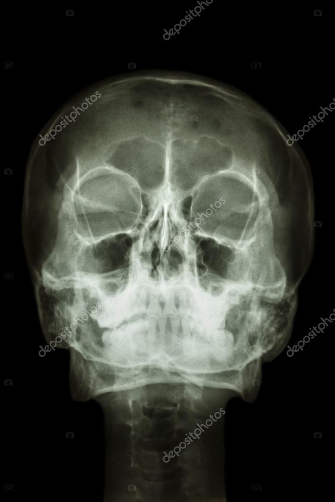 Normal human's skull and cervical spine — Stock Photo © stockdevil_666 ...