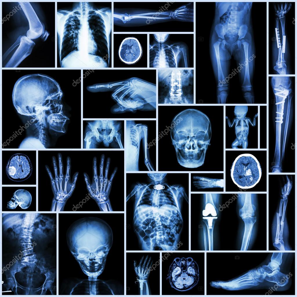 Orthopedic Surgeon X Rays