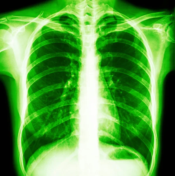 Normal human's chest — Stock Photo © stockdevil_666 #61372581