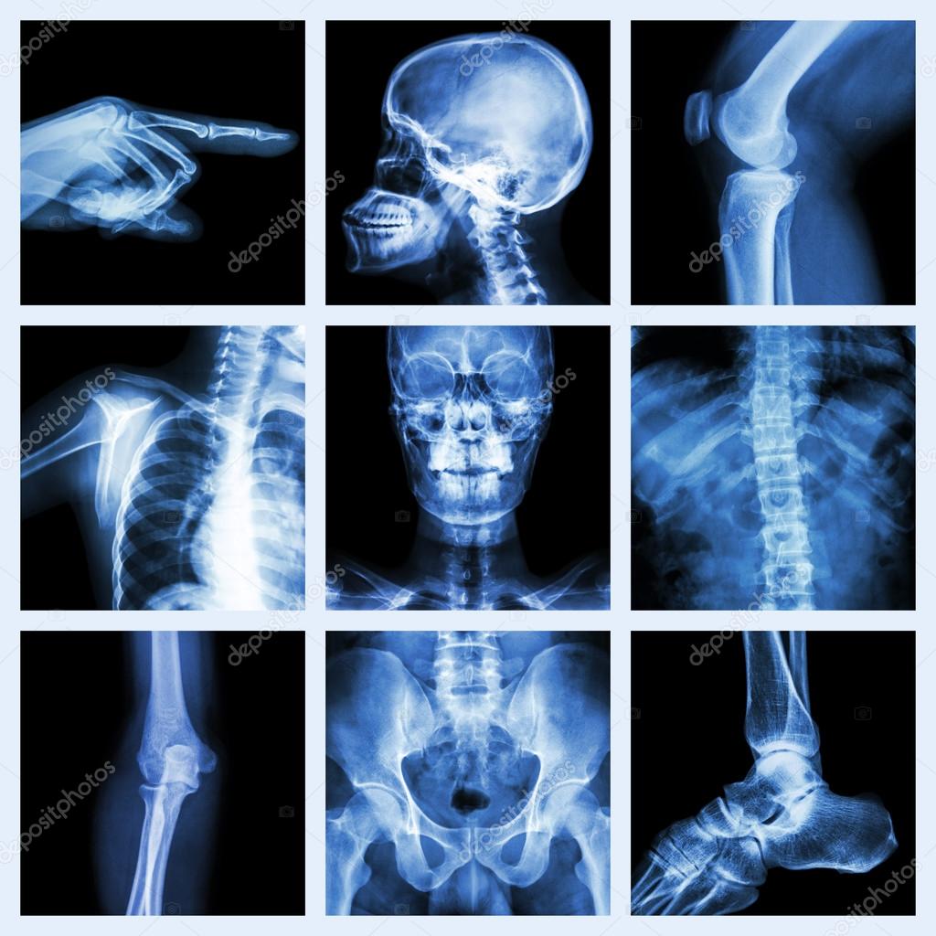 Collection X-ray part of human (Version 2) — Stock Photo © stockdevil ...