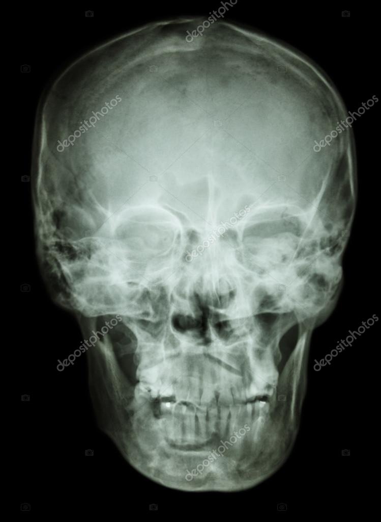 Normal human skull — Stock Photo © stockdevil_666 #61372699